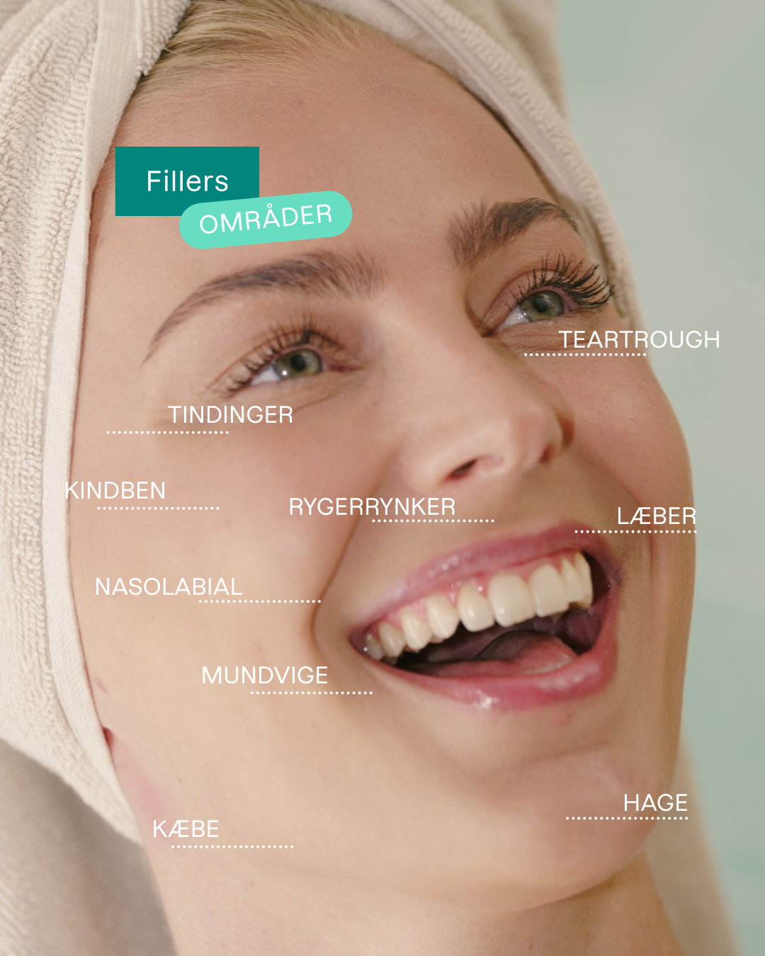 Filler Offer - SMOOTH